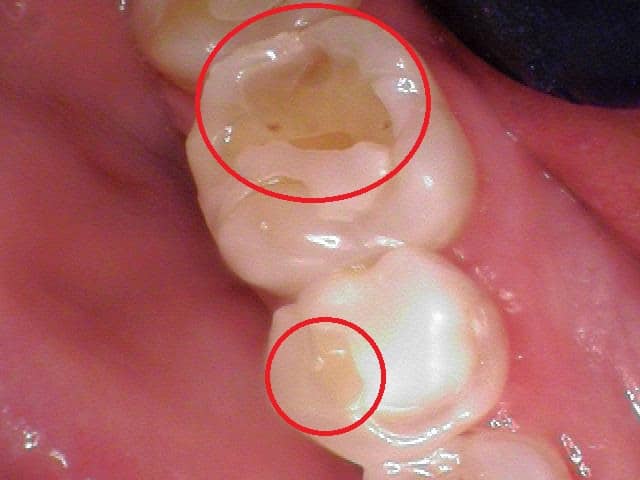 Dental Care for Seniors [Gerodontics]-Complete Guide | Cranford Dental