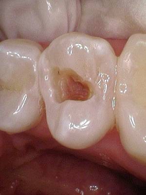 Dental Photography=WOW Patient Experience | Cranford Dental