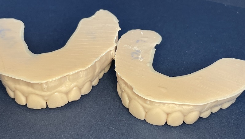 3D Printing--WOW Dental Experience | Cranford Dental