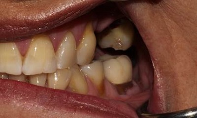 3D Printing--WOW Dental Experience | Cranford Dental