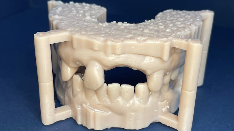 3D Printing--WOW Dental Experience | Cranford Dental